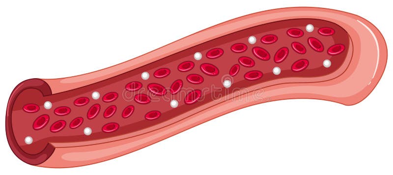 Blood Clot Cartoon Stock Illustrations – 184 Blood Clot Cartoon Stock ...
