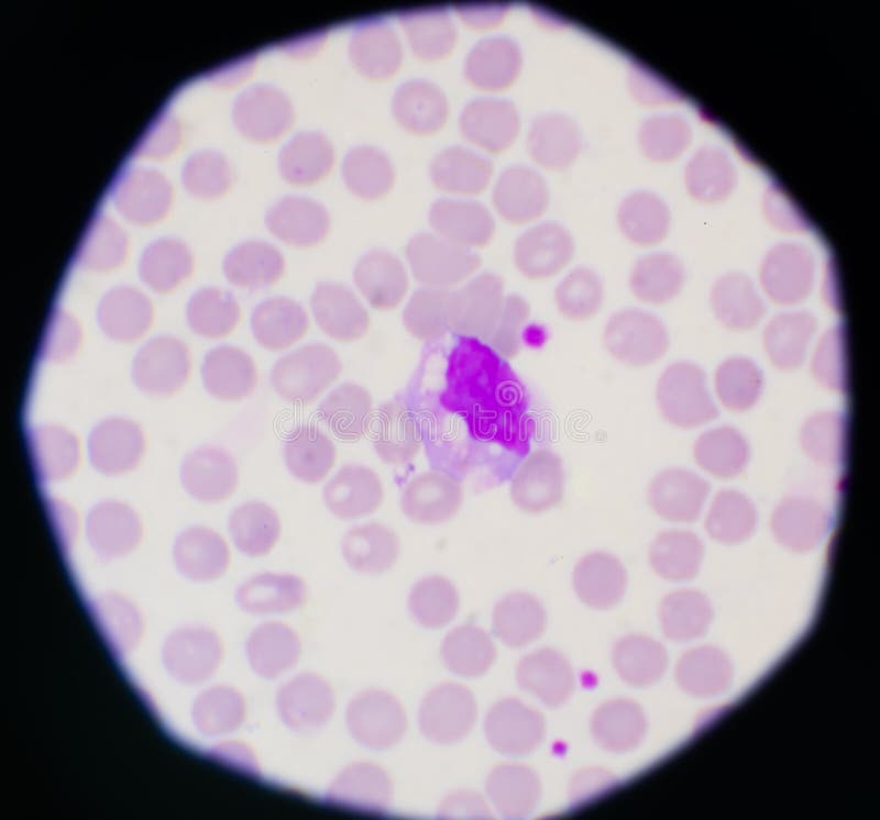 Red Blood Cells and White Blood Cells Background Stock Photo - Image of ...