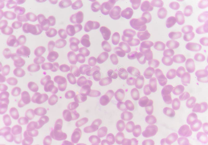 Red Blood Cells with White Blood Cells Stock Image - Image of cells ...