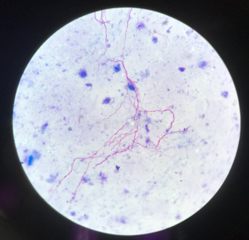 Red Branching Mycobacterium Tuberculosis on Blue Background in Modified ...