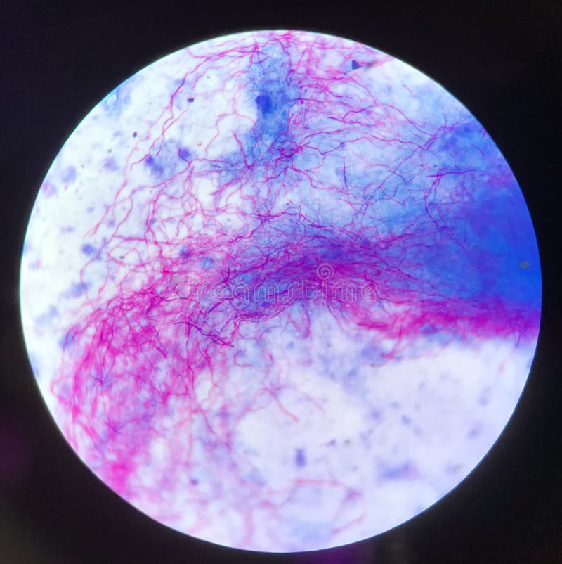 Red Branching Mycobacterium Tuberculosis on Blue Background in Modified ...