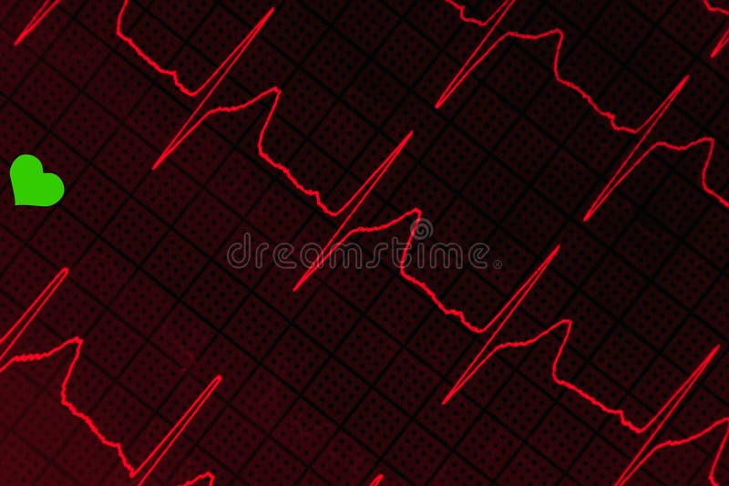 Red Cardiogram on a Black and Red Square Shaped Background Stock Image ...