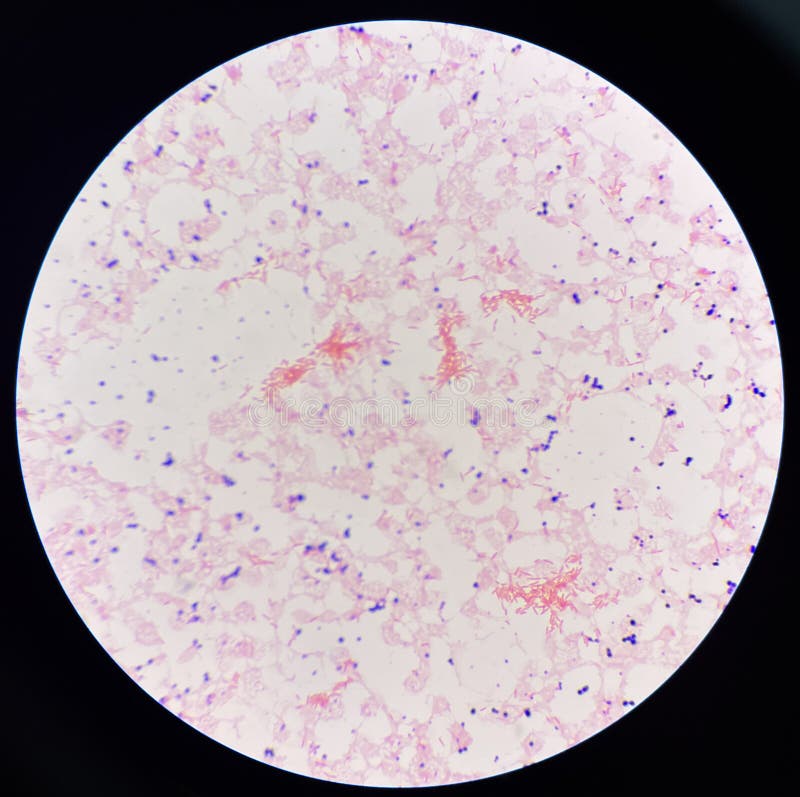 Red Cell Gram Negative Bacilli in Hemo Culture Stock Photo - Image of ...