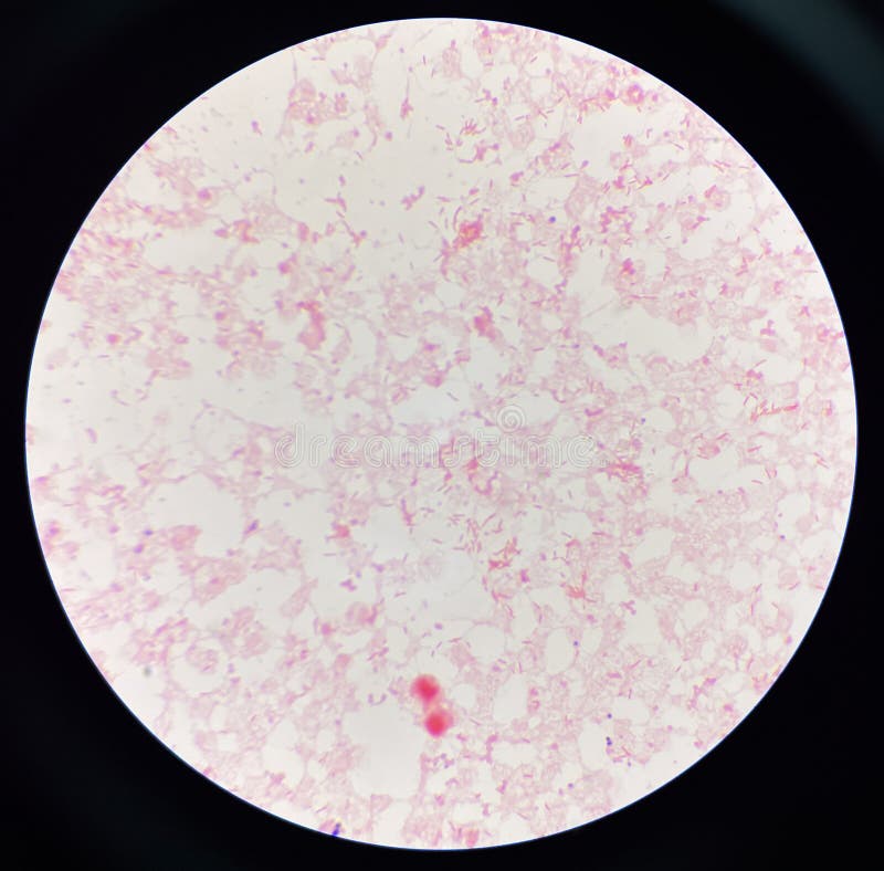 Red Cell Gram Negative Bacilli in Hemo Culture Stock Photo - Image of ...
