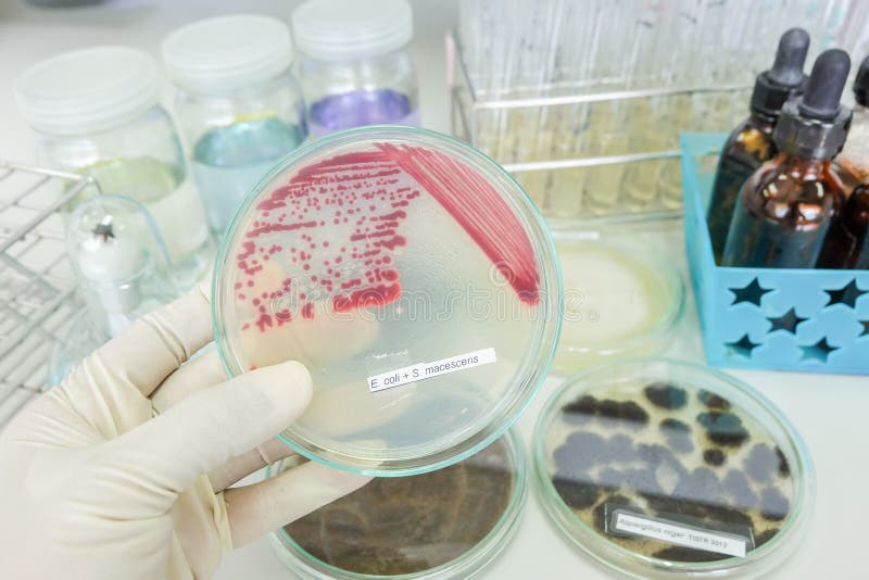Red colony of bacteria stock photo. Image of medical - 93206086