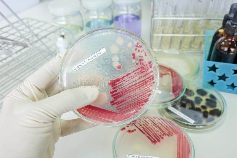 Red colony of bacteria stock image. Image of penicillin - 93206117