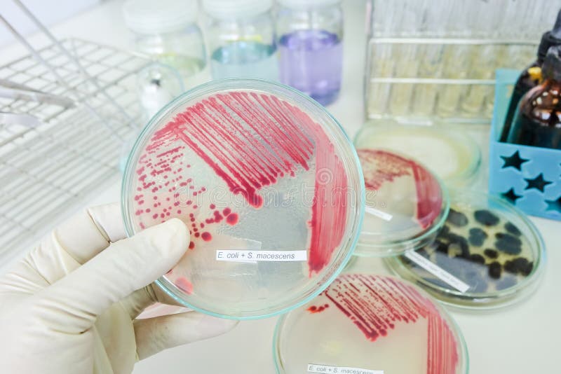 Red colony of bacteria stock image. Image of agar, experimental - 93206129