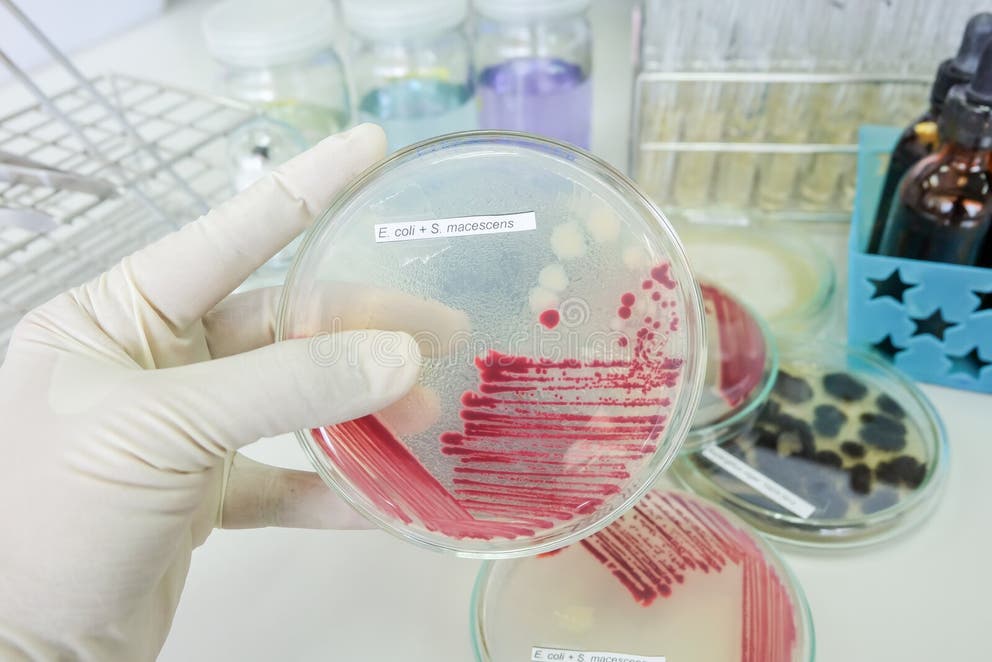 Red colony of bacteria stock image. Image of macro, education - 93206155