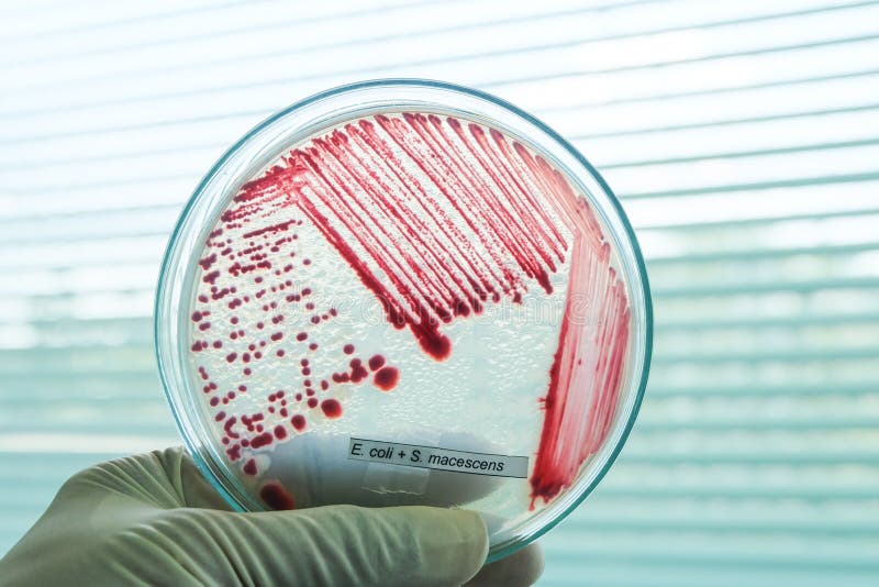 Red colony of bacteria stock image. Image of macro, medicine - 93206383