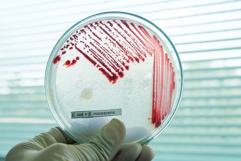 Red colony of bacteria stock image. Image of medicine - 93206385