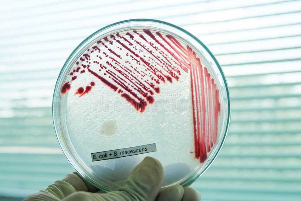 Red colony of bacteria stock image. Image of organism - 93206399