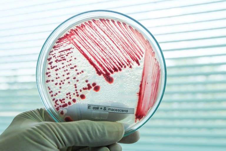 Red colony of bacteria stock image. Image of experiment - 93206435