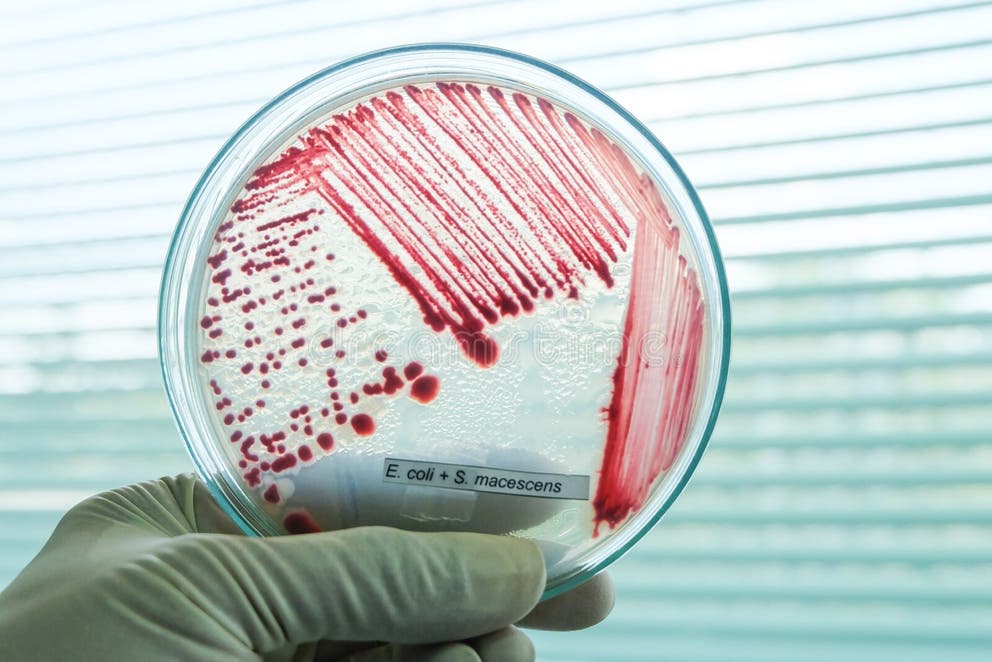 Red colony of bacteria stock image. Image of experiment - 93206435