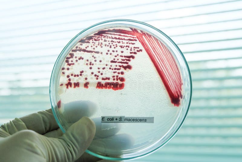Red colony of bacteria stock photo. Image of experiment - 93206452