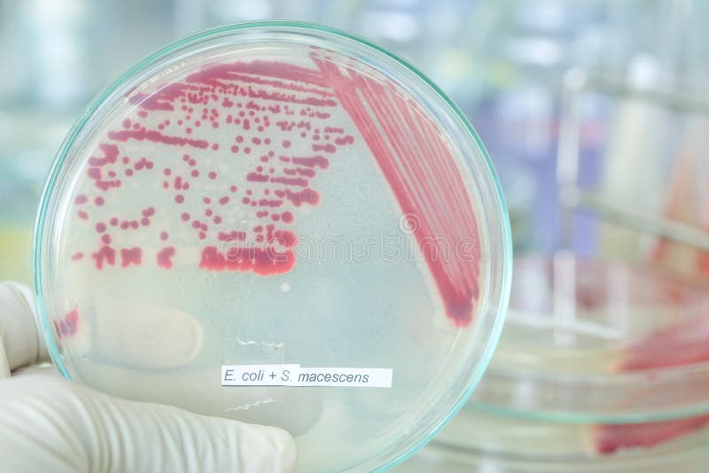 Red colony of bacteria stock photo. Image of grow, biotechnology - 93206728