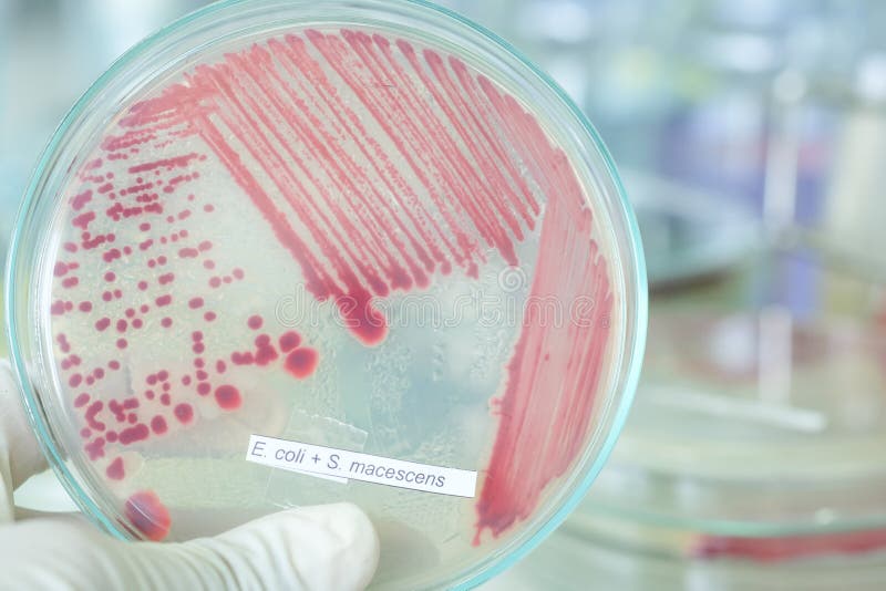 Red colony of bacteria stock photo. Image of molecular - 93206752