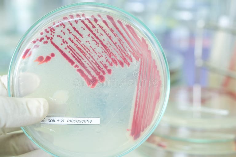 Red colony of bacteria stock photo. Image of experiment - 93206768