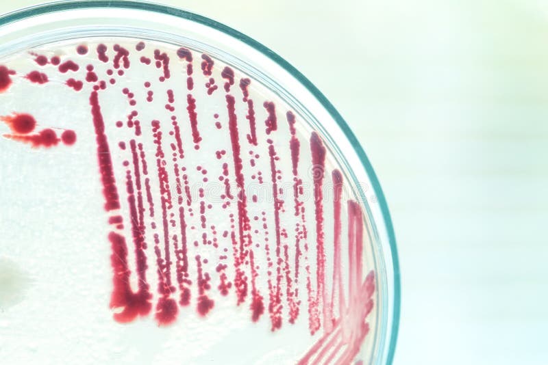 Red colony of bacteria stock photo. Image of biotechnology - 93206882