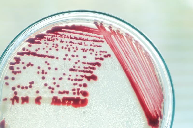 Red colony of bacteria stock photo. Image of chemical - 93206980
