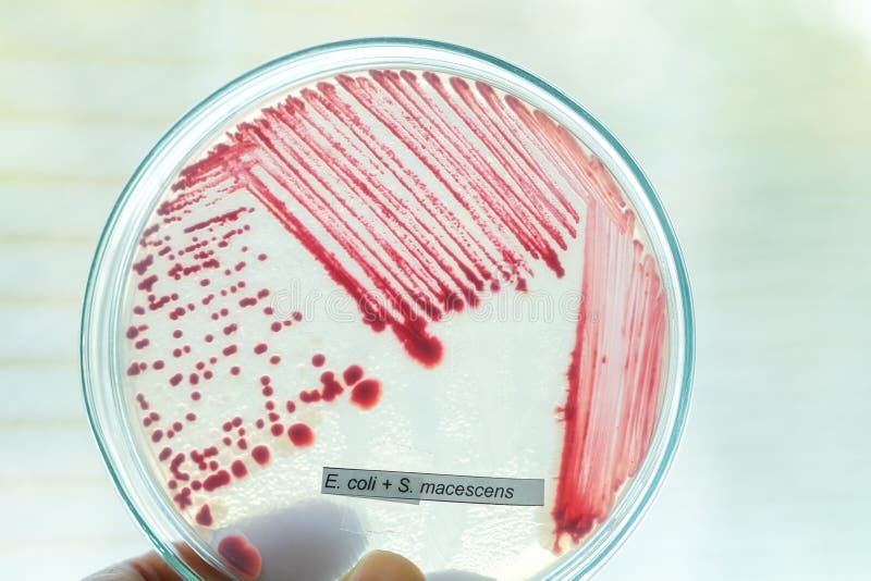Red Colony of bacteria stock photo. Image of experiment - 93206632
