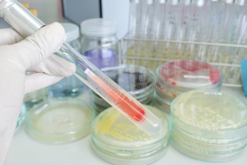 Red Colony of bacteria stock image. Image of macro, investigation ...