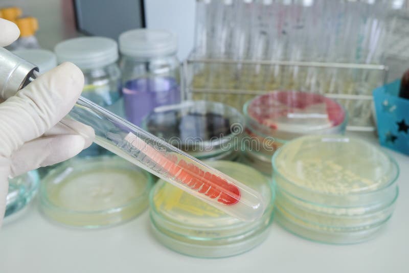 Red Colony of bacteria stock photo. Image of culture - 93206478