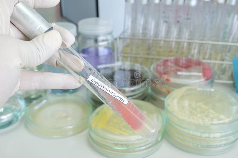 Red Colony of bacteria stock photo. Image of medicine - 93206498