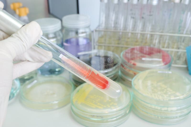 Red Colony of bacteria stock image. Image of colony, molecular - 93206501