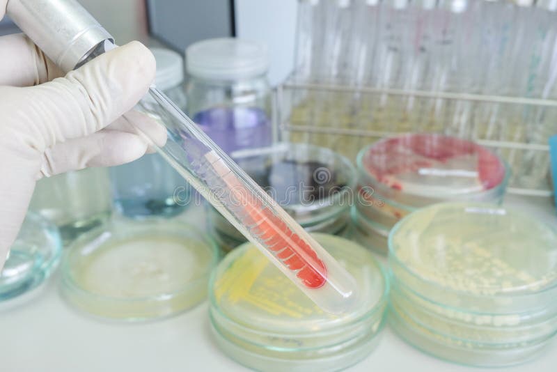 Red Colony of bacteria stock image. Image of culture - 93206615