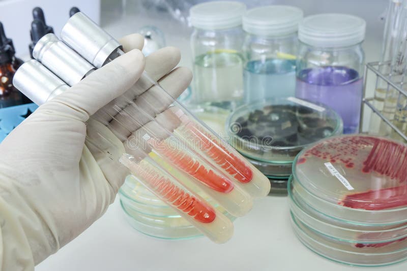 Red Colony of bacteria stock photo. Image of antibiotic - 93206616