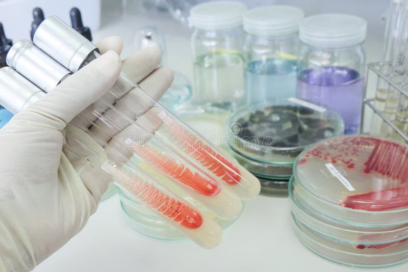 Red Colony of bacteria stock photo. Image of experiment - 93206632