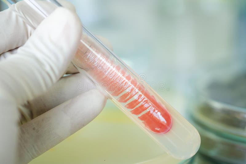 Red Colony of bacteria stock image. Image of grow, medicine - 93206727