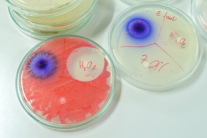 Red Colony of Becteria in Petridish Stock Image - Image of blue ...