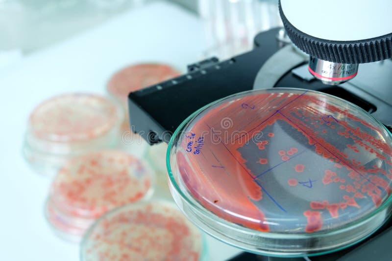 Red Colony of Becteria in Petridish Stock Image - Image of microbiology ...