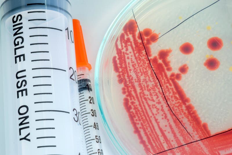 Red Colony of Becteria in Petridish Stock Photo - Image of care ...