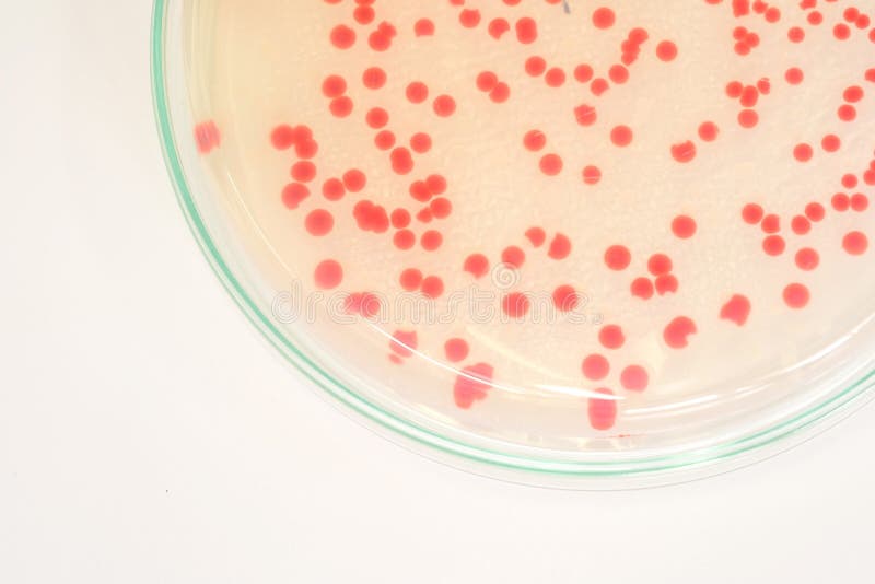 Red Colony of Becteria in Petridish Stock Photo - Image of bacterial ...