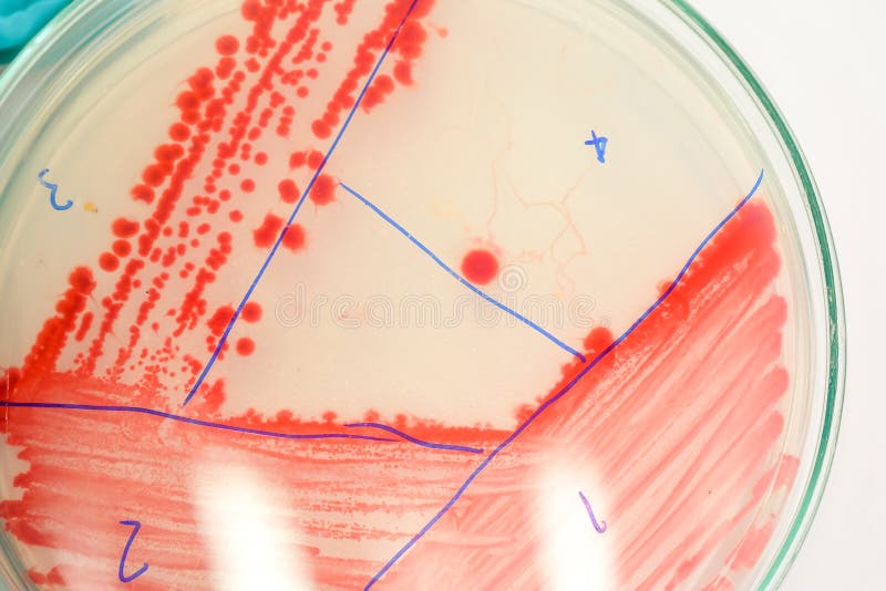 Red Colony of Becteria in Petridish Stock Photo - Image of microbiology ...