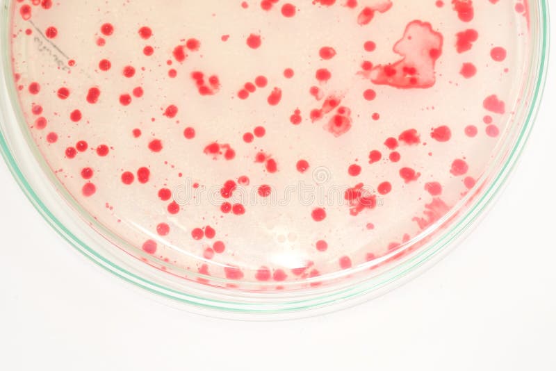 Red Colony of Becteria in Petridish Stock Image - Image of experiment ...