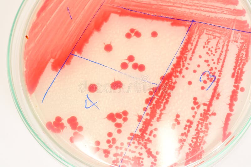 Red Colony of Becteria in Petridish Stock Photo - Image of care ...