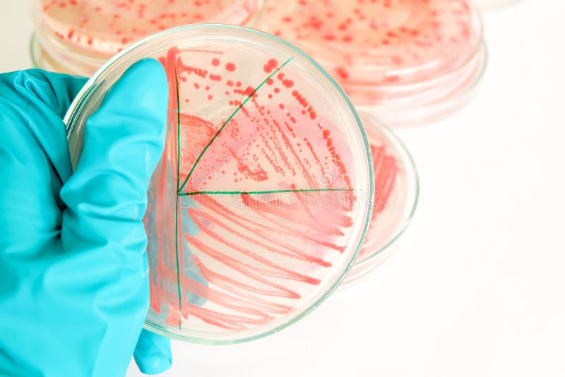 Red Colony of Becteria in Petridish Stock Photo - Image of culture ...