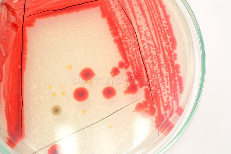Red Colony of Becteria in Petridish Stock Image - Image of medicine ...