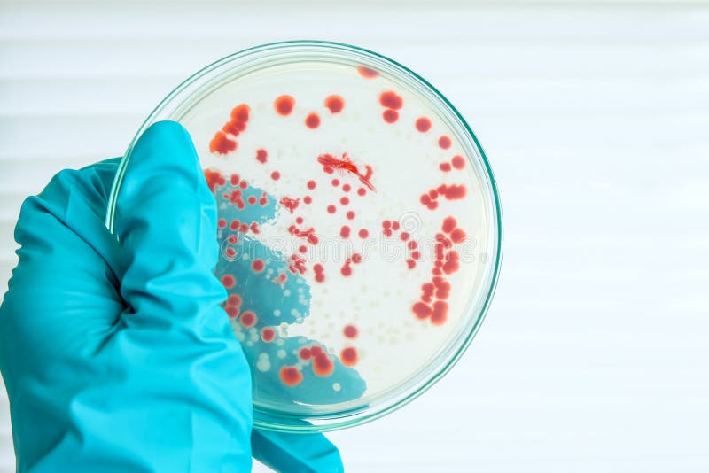 Red Colony of Becteria in Petridish Stock Image - Image of care, colony ...