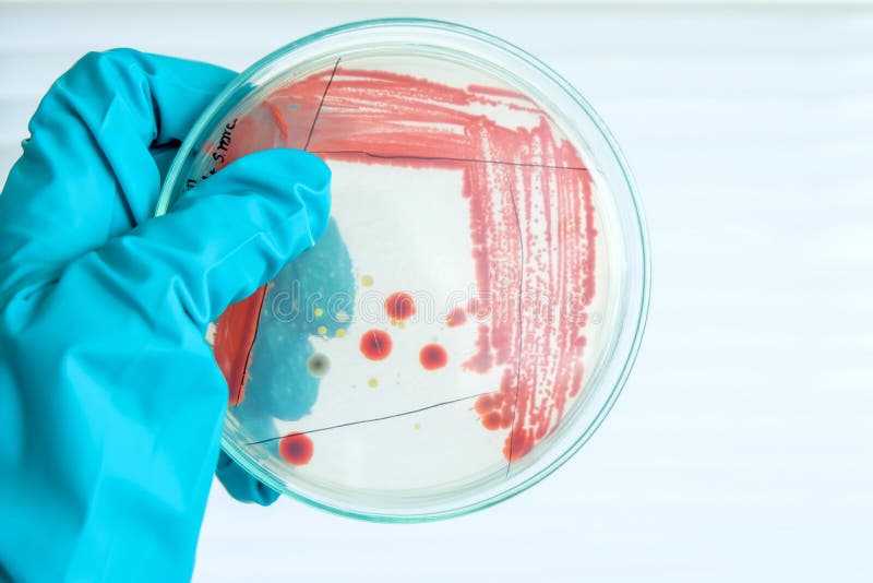 Red Colony of Becteria in Petridish Stock Photo - Image of medical ...