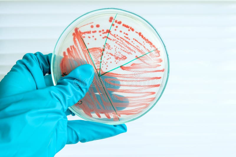 Red Colony of Becteria in Petridish Stock Image - Image of medical ...