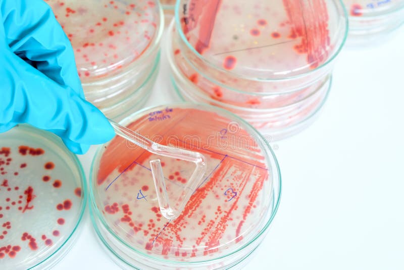 Red Colony of Becteria in Petridish Stock Photo - Image of bacterial ...