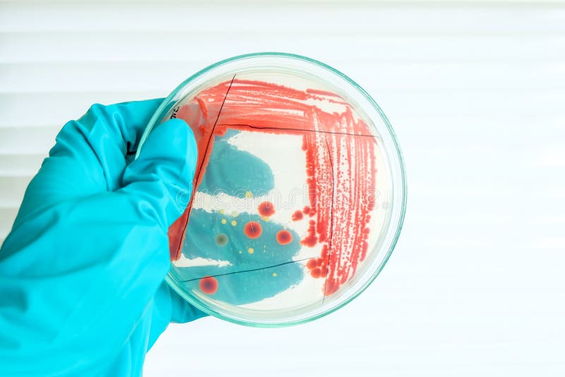 Red Colony of Becteria in Petridish Stock Photo - Image of fungi, agar ...