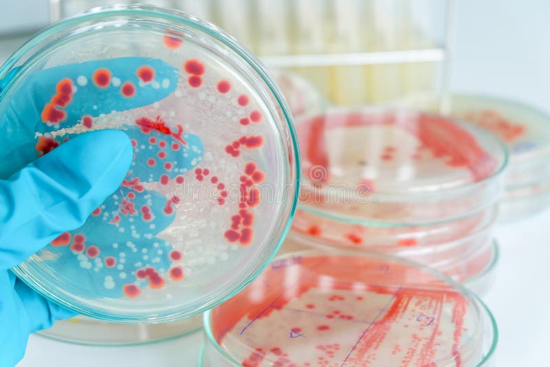 Red Colony of Becteria in Petridish Stock Image - Image of growth, grow ...