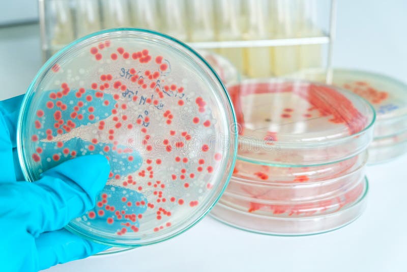 Red Colony of Becteria in Petridish Stock Image - Image of ...