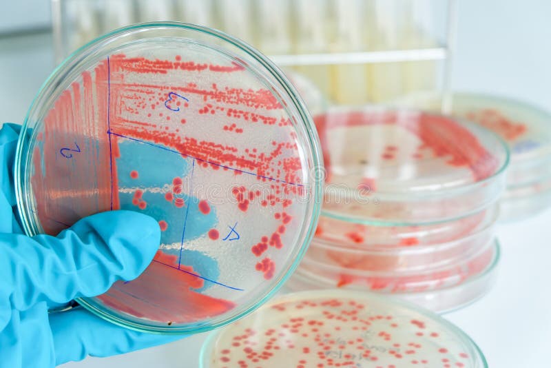 Red Colony of Becteria in Petridish Stock Image - Image of culture ...
