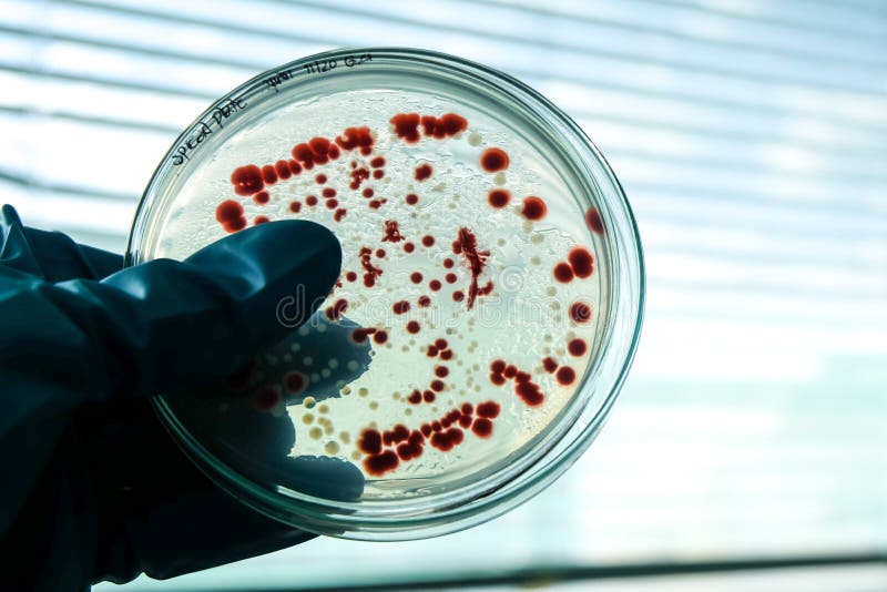 Red Colony of Becteria in Petridish Stock Image - Image of chemical ...